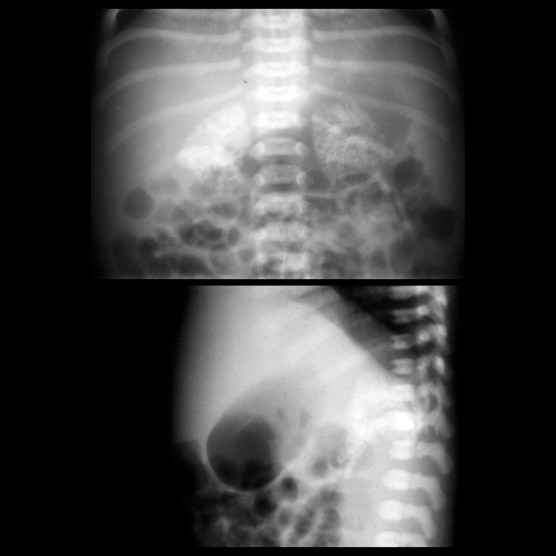 Infant with failure to thrive | Pediatric Radiology Case | Pediatric ...