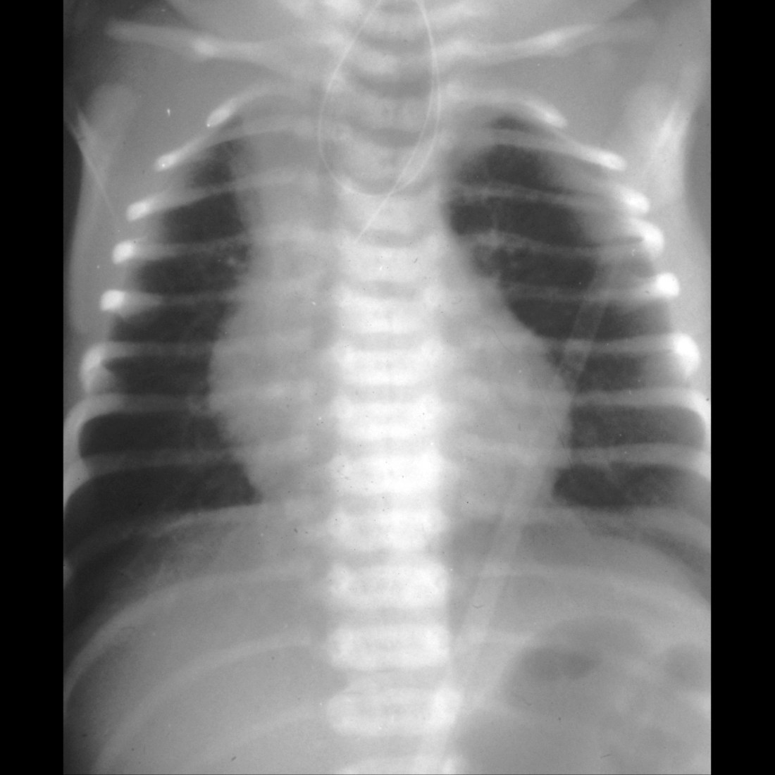 February 11, 2019 – Pediatric Imaging