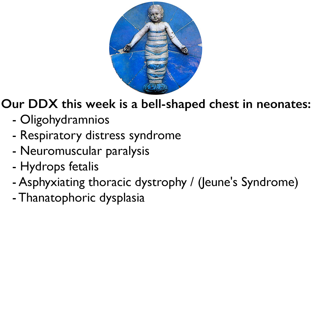 Our DDX For This Week Is | Pediatric Radiology Case | Pediatric Imaging ...