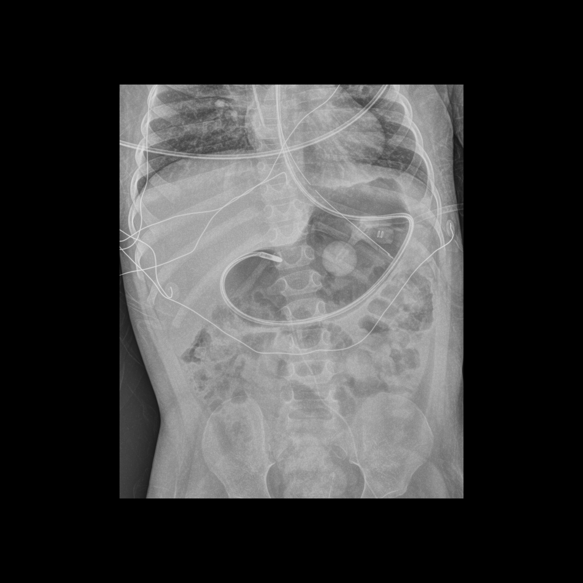 April 4, 2020 – Pediatric Imaging