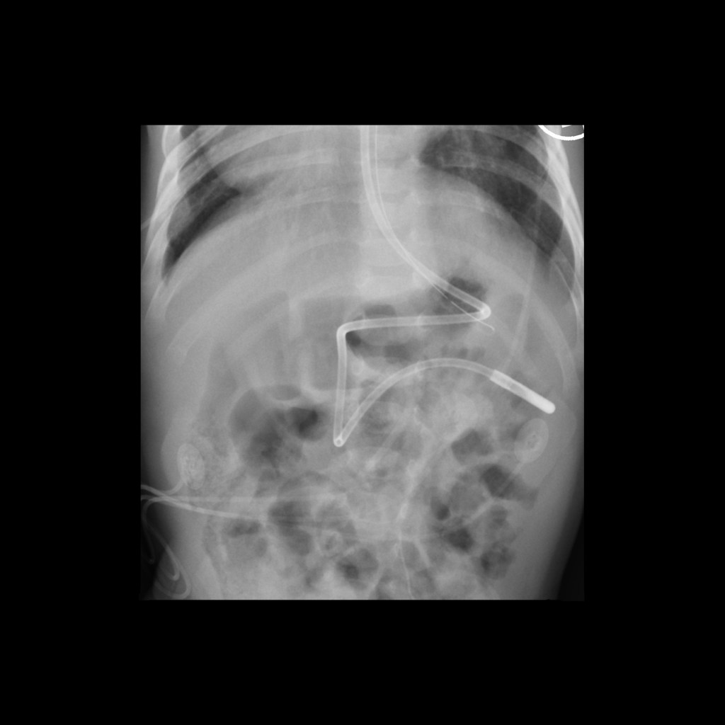 April 8, 2020 – Pediatric Imaging