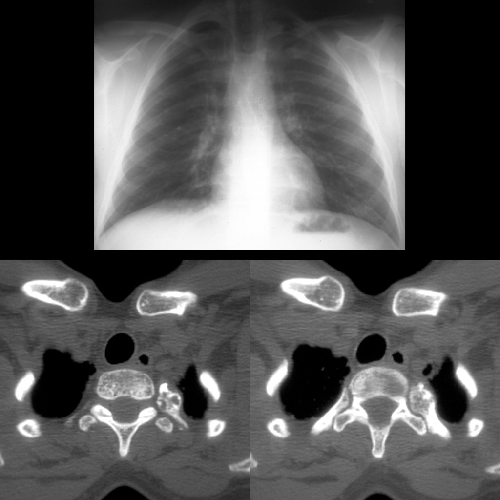 May 19, 2020 – Pediatric Imaging