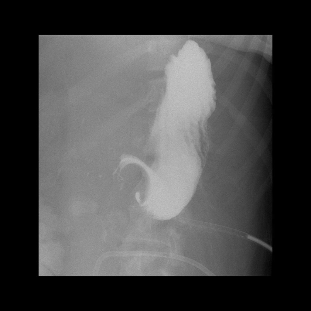 June 22, 2020 – Pediatric Imaging