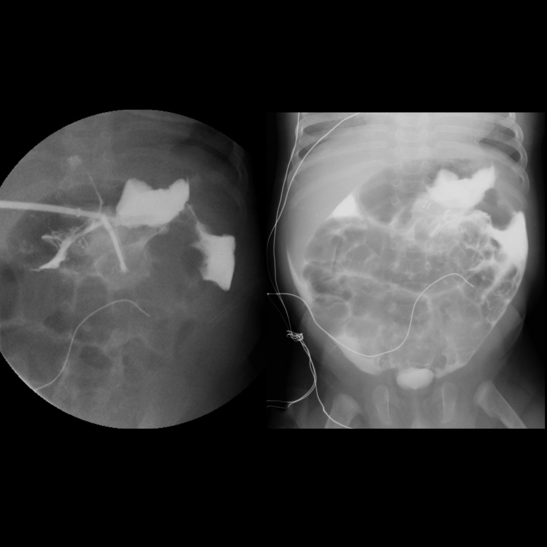 June 21, 2020 – Pediatric Imaging