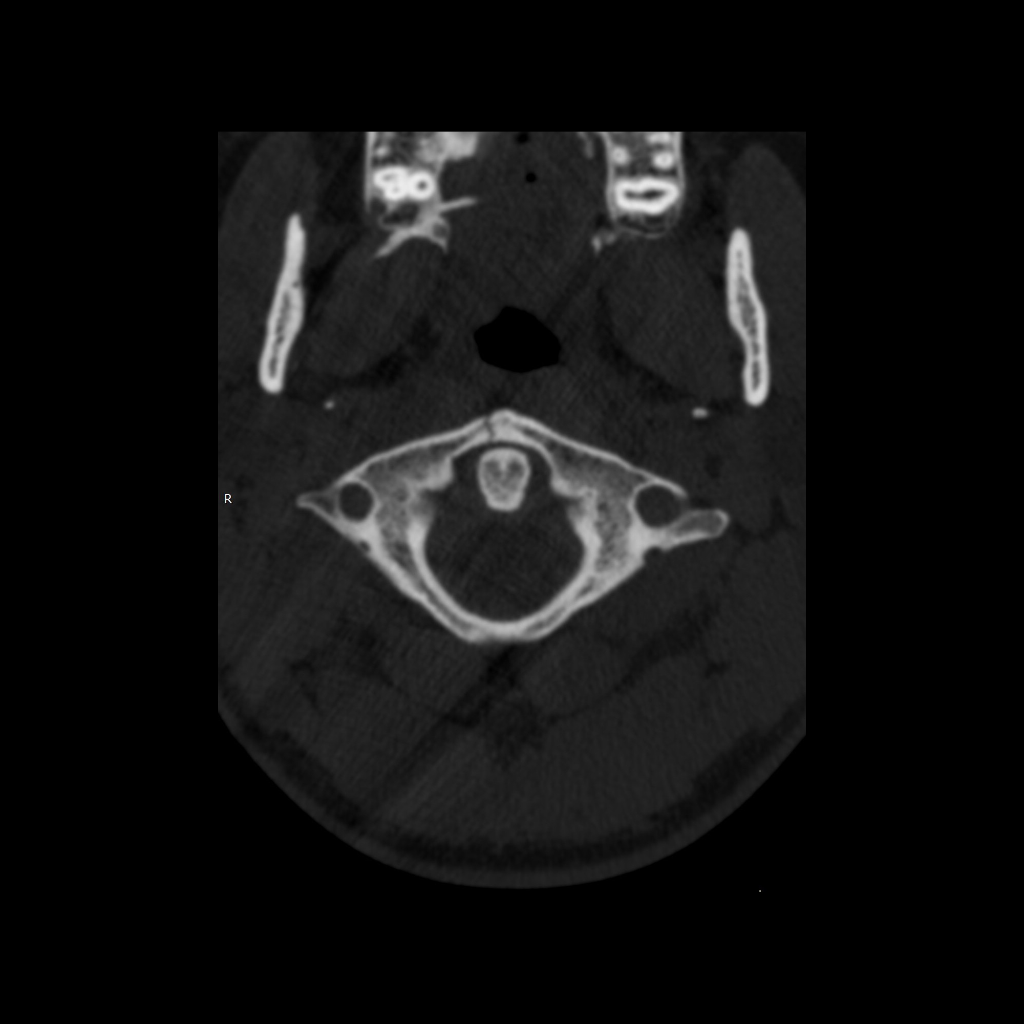 December 27, 2020 – Pediatric Imaging