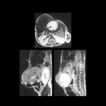Pentalogy of Cantrell | Pediatric Radiology Reference Article ...