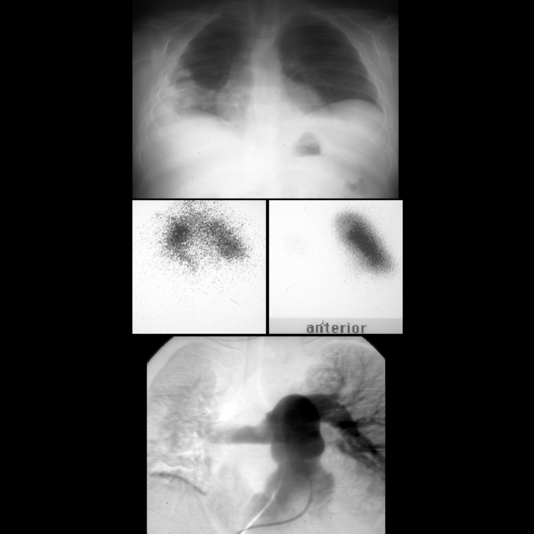 April 13, 2021 – Pediatric Imaging
