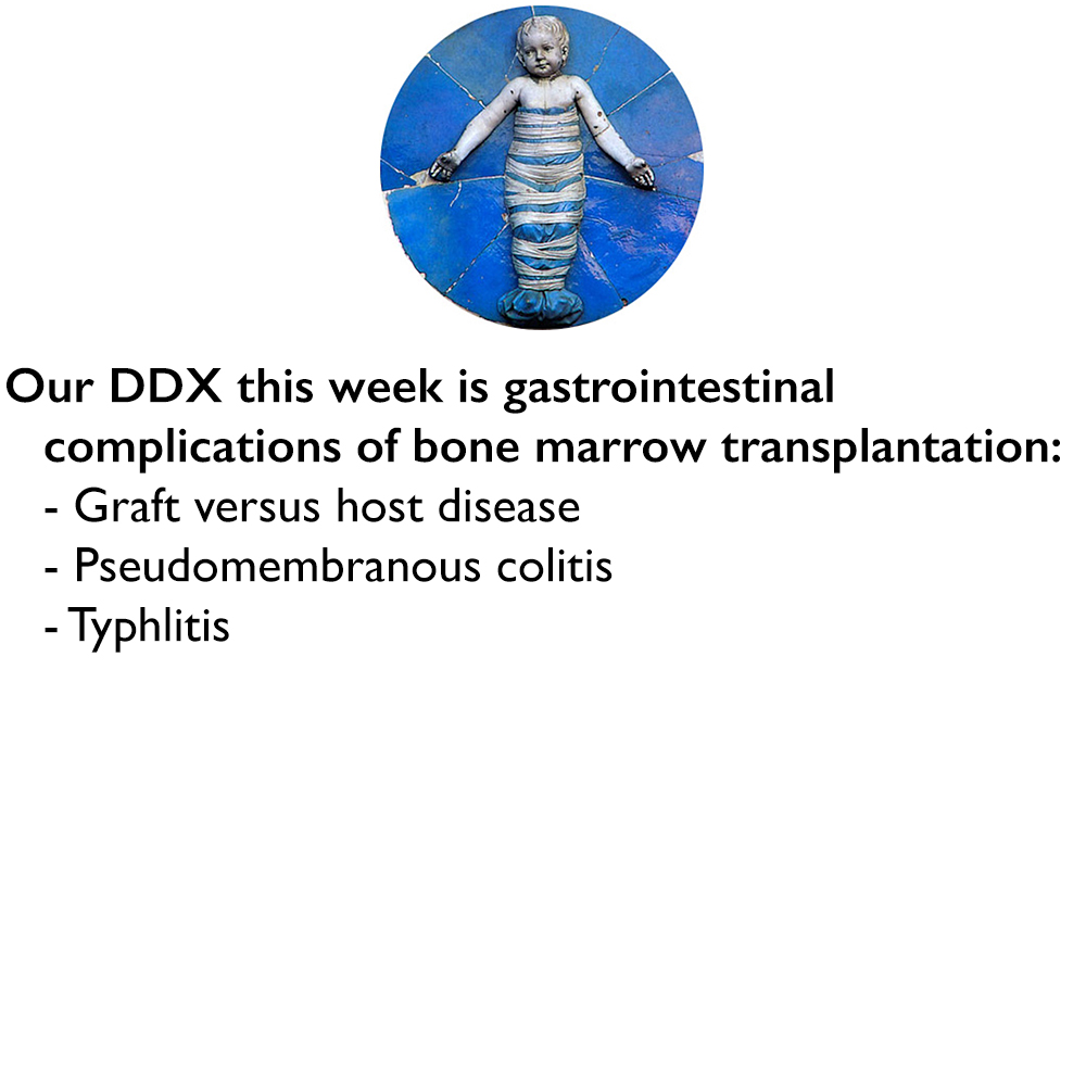 Our DDX For This Week Is | Pediatric Radiology Case | Pediatric Imaging ...