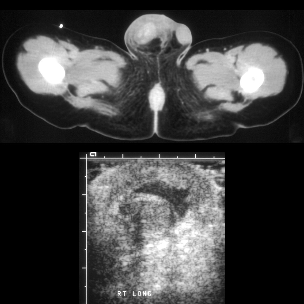 August 16, 2021 – Pediatric Imaging