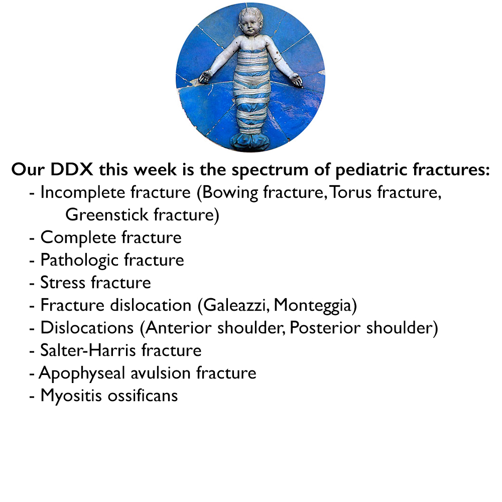 PIDDXFracturesSpectrum | Pediatric Radiology Case | Pediatric Imaging ...