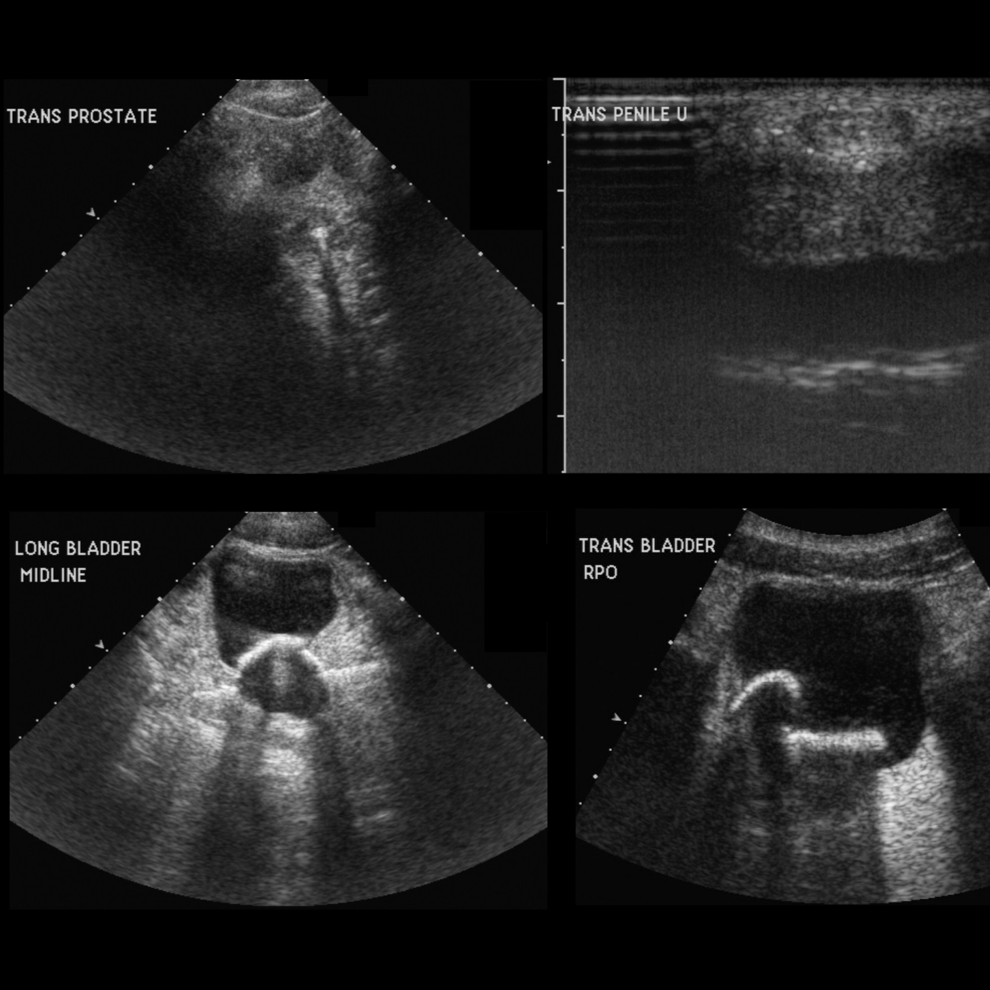 Pediatric Urethral Trauma | Pediatric Radiology Reference Article ...