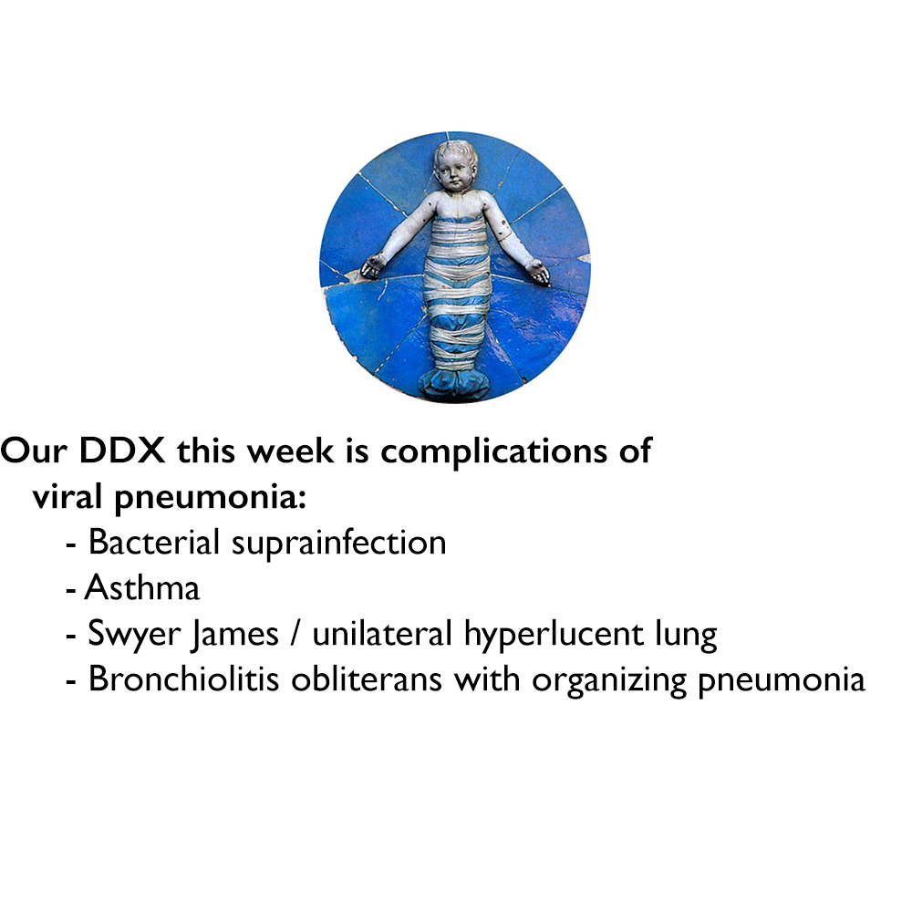 Our DDX For This Week Is | Pediatric Radiology Case | Pediatric Imaging ...