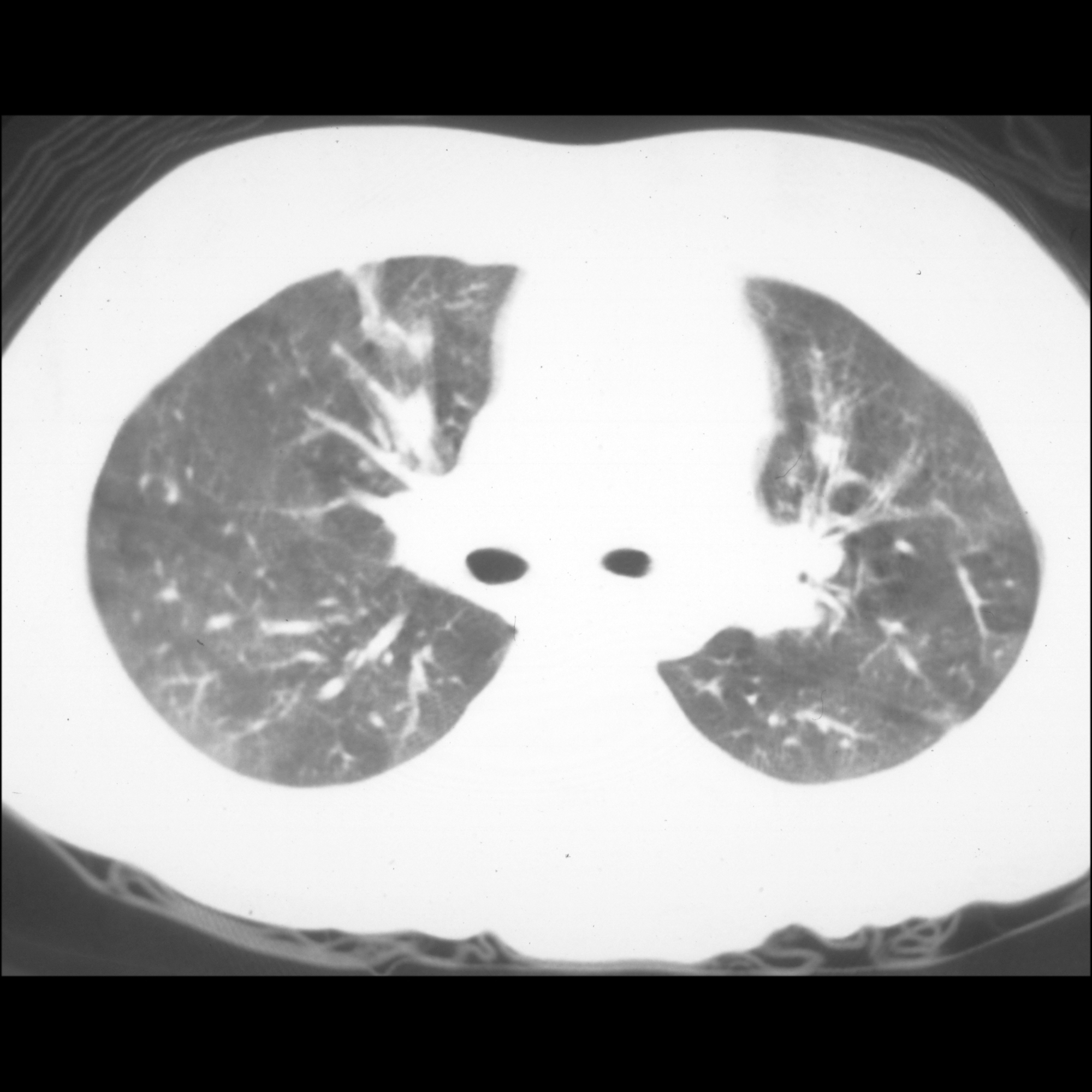 April 29, 2023 – Pediatric Imaging