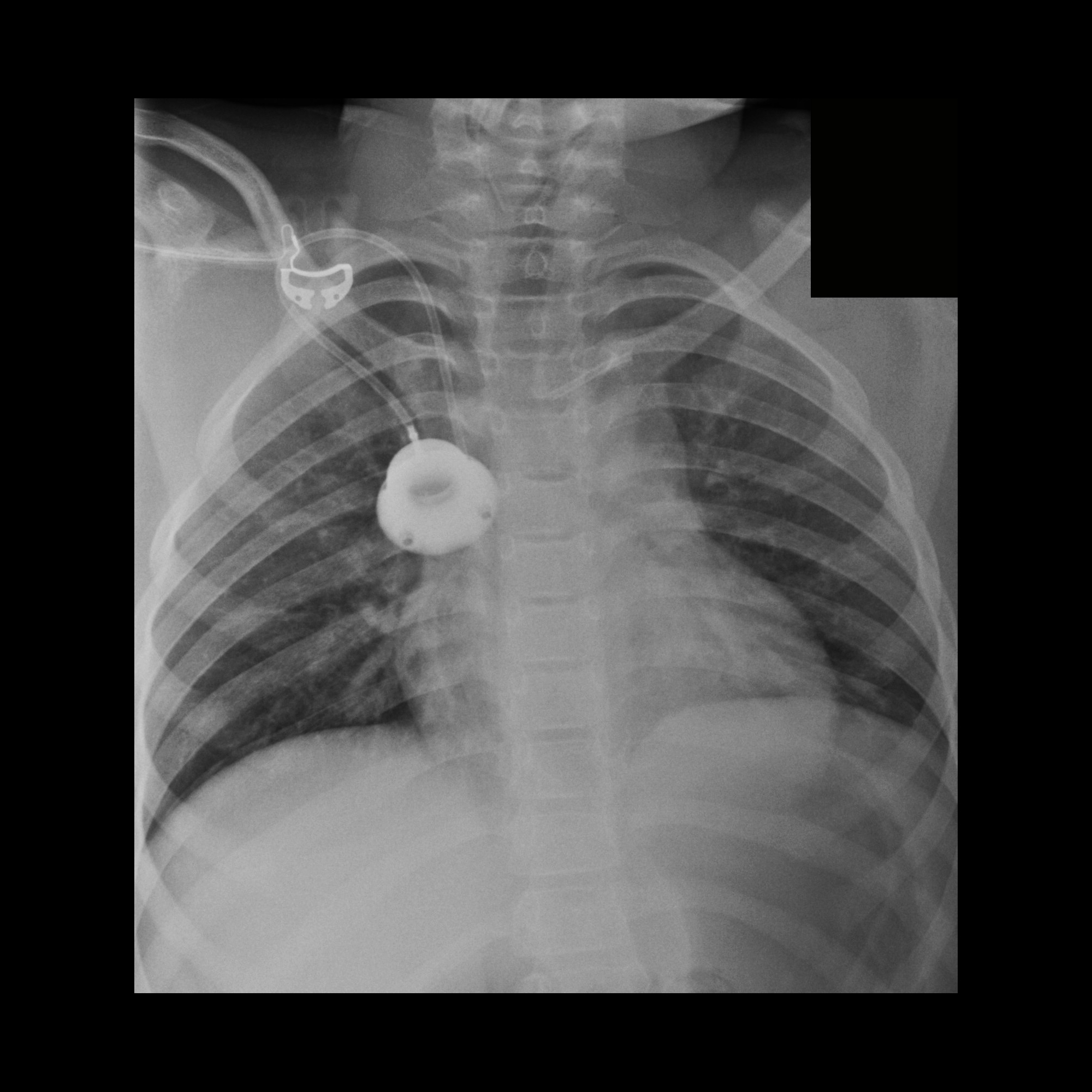 October 27, 2023 – Pediatric Imaging