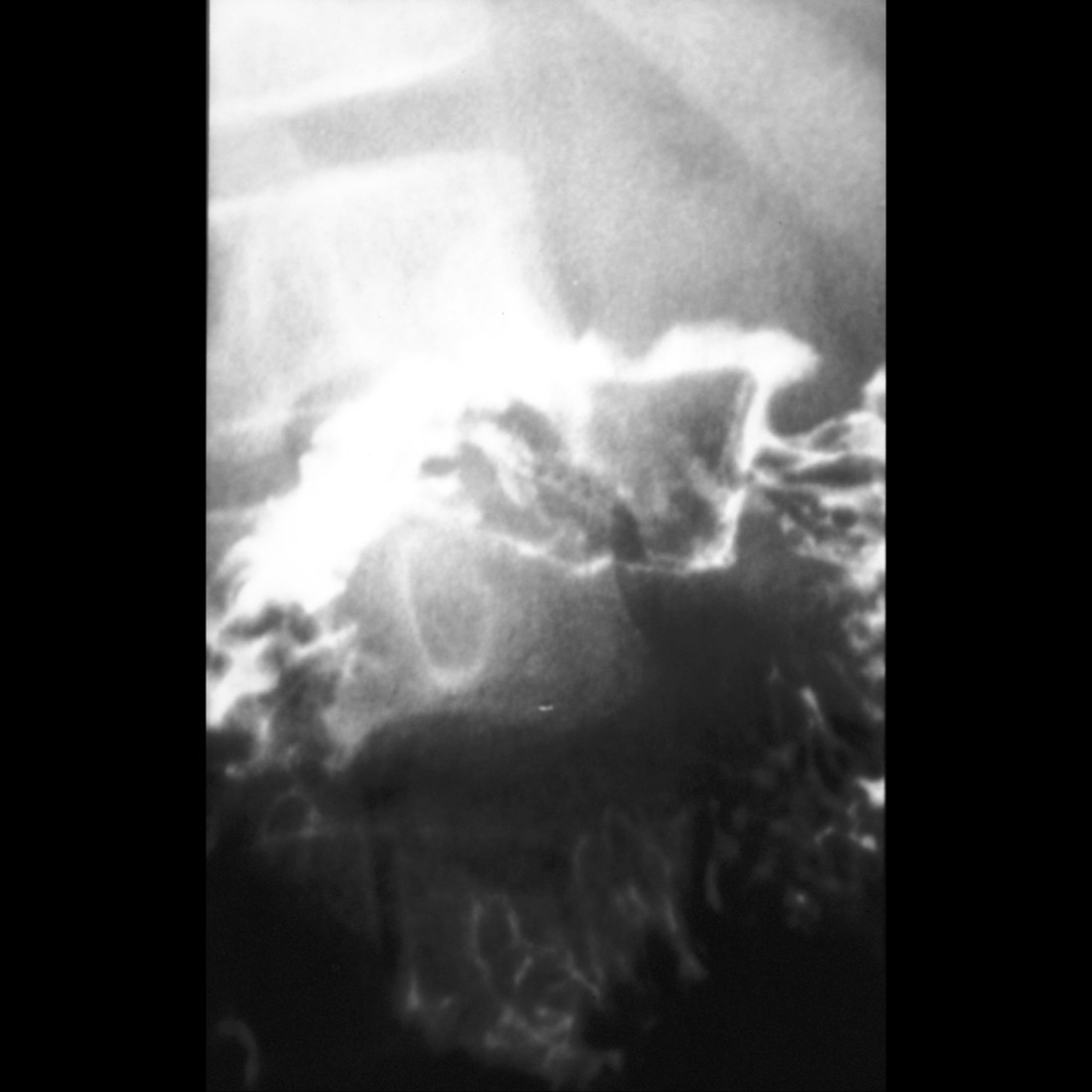 Teenager with epigastric pain and lower abdominal pain | Pediatric ...