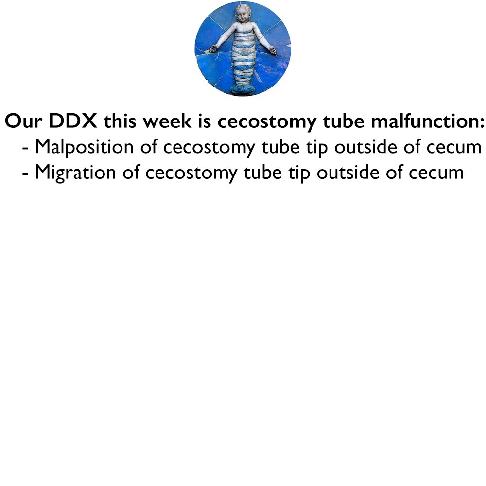 Our DDX For This Week Is | Pediatric Radiology Case | Pediatric Imaging ...