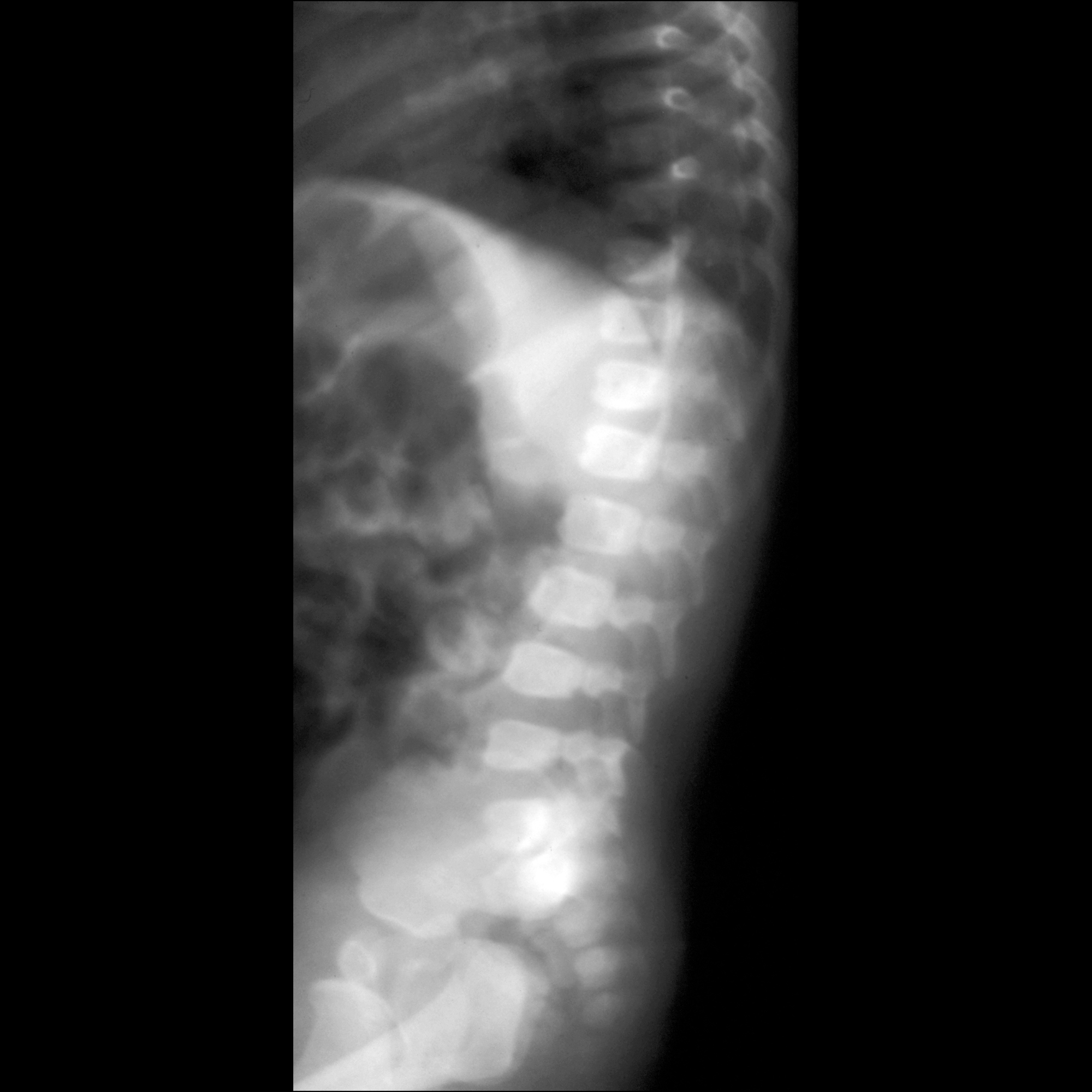 Pediatric Imaging : A Pediatric Radiology Textbook and Pediatric ...