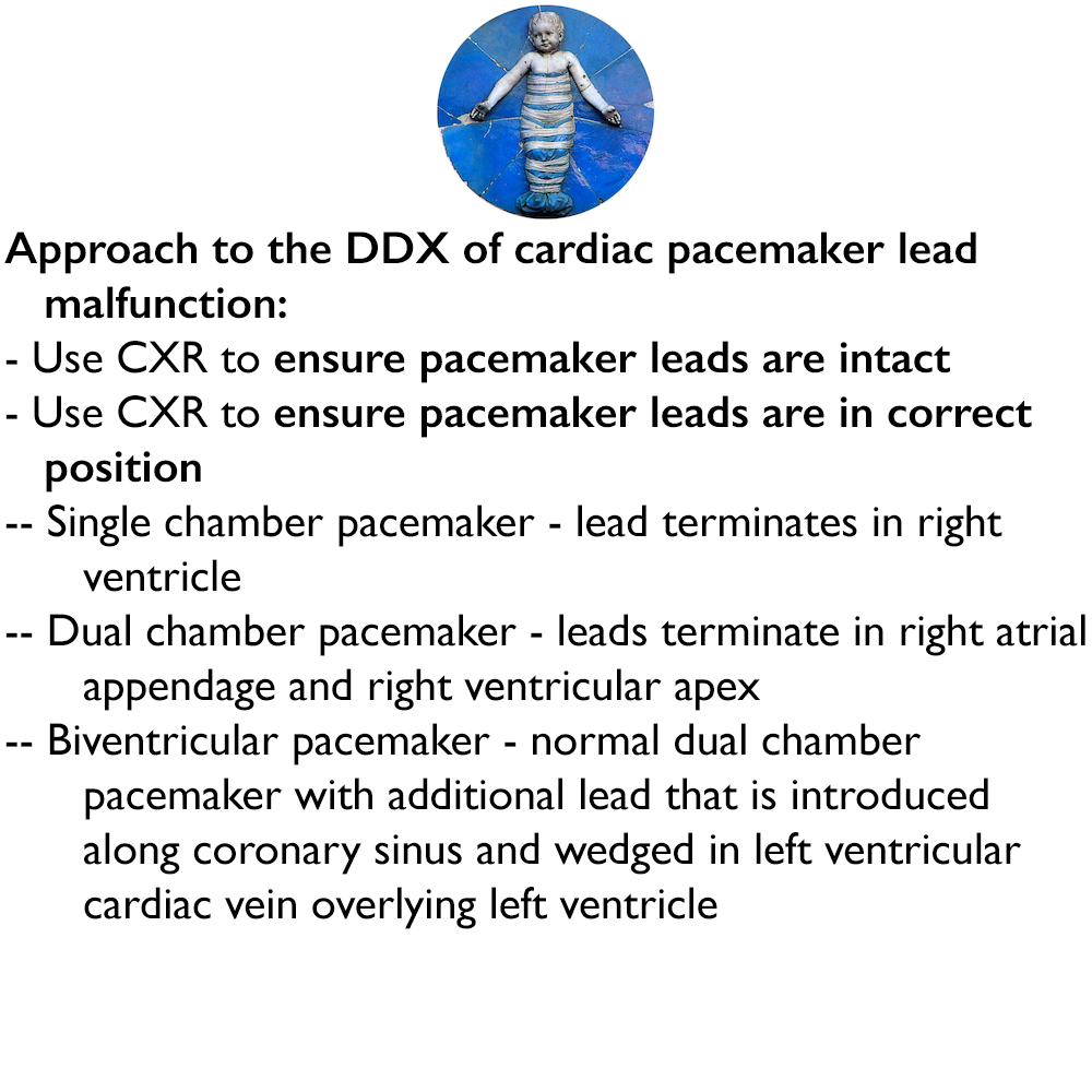 Pediatric Imaging Pearl of the Week | Pediatric Radiology Case ...