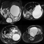 Genitourinary – Pediatric Imaging