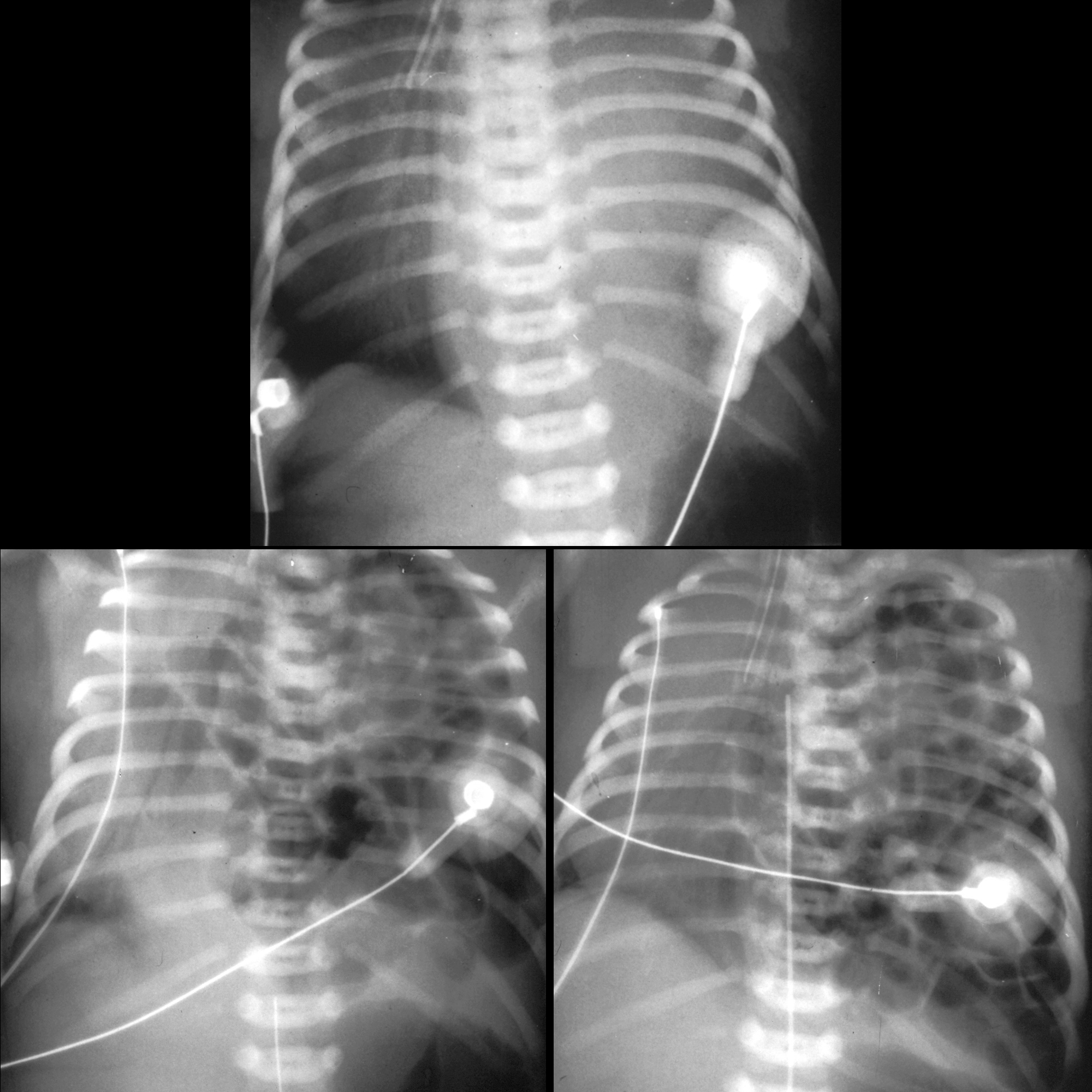 Chest – Pediatric Imaging