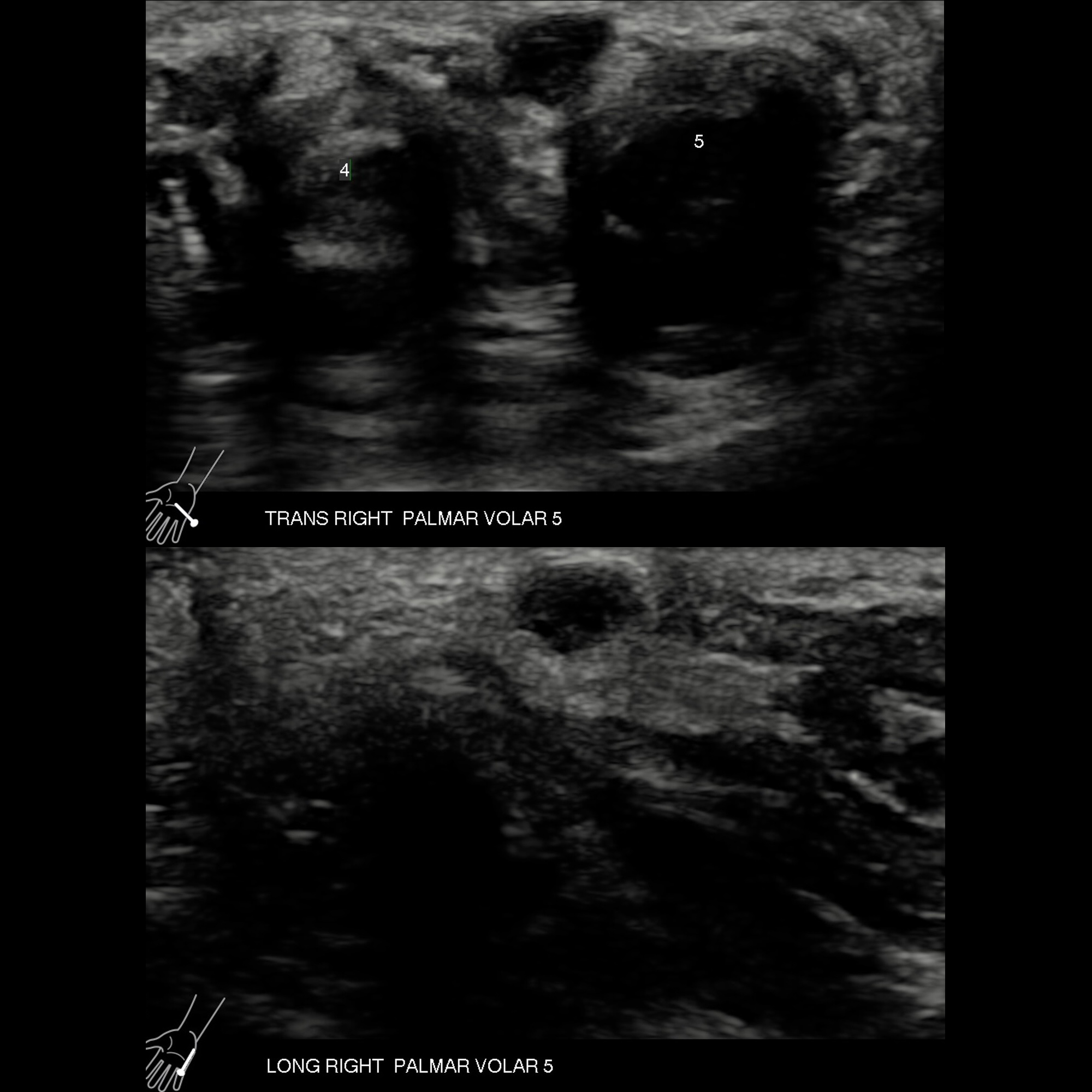 Pediatric Imaging : A Pediatric Radiology Textbook and Pediatric ...