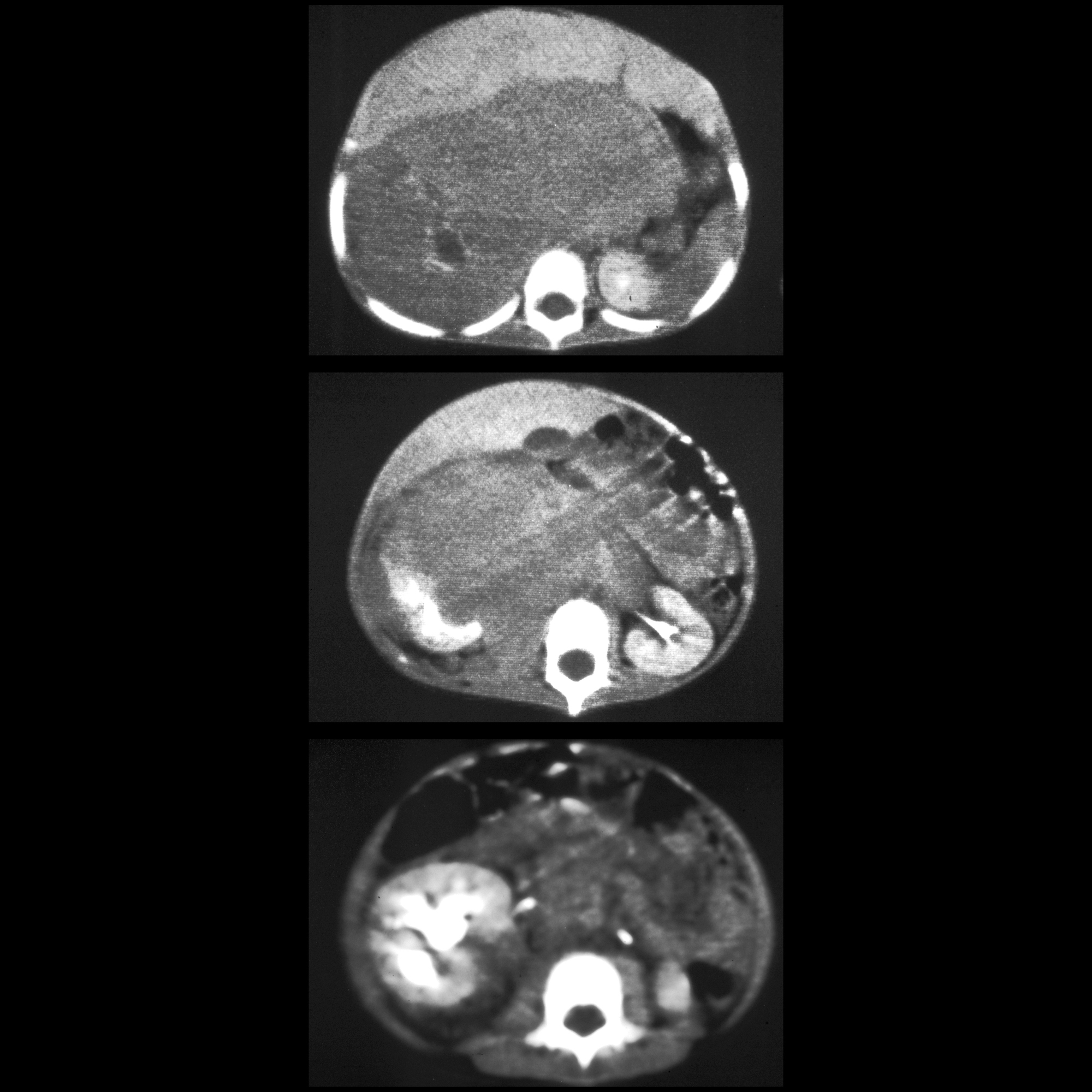 Genitourinary – Pediatric Imaging