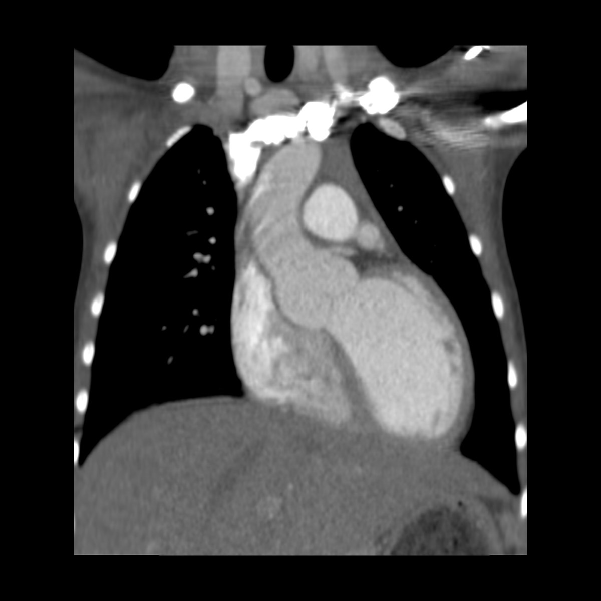 Preschooler with a connective tissue disease | Pediatric Radiology Case ...