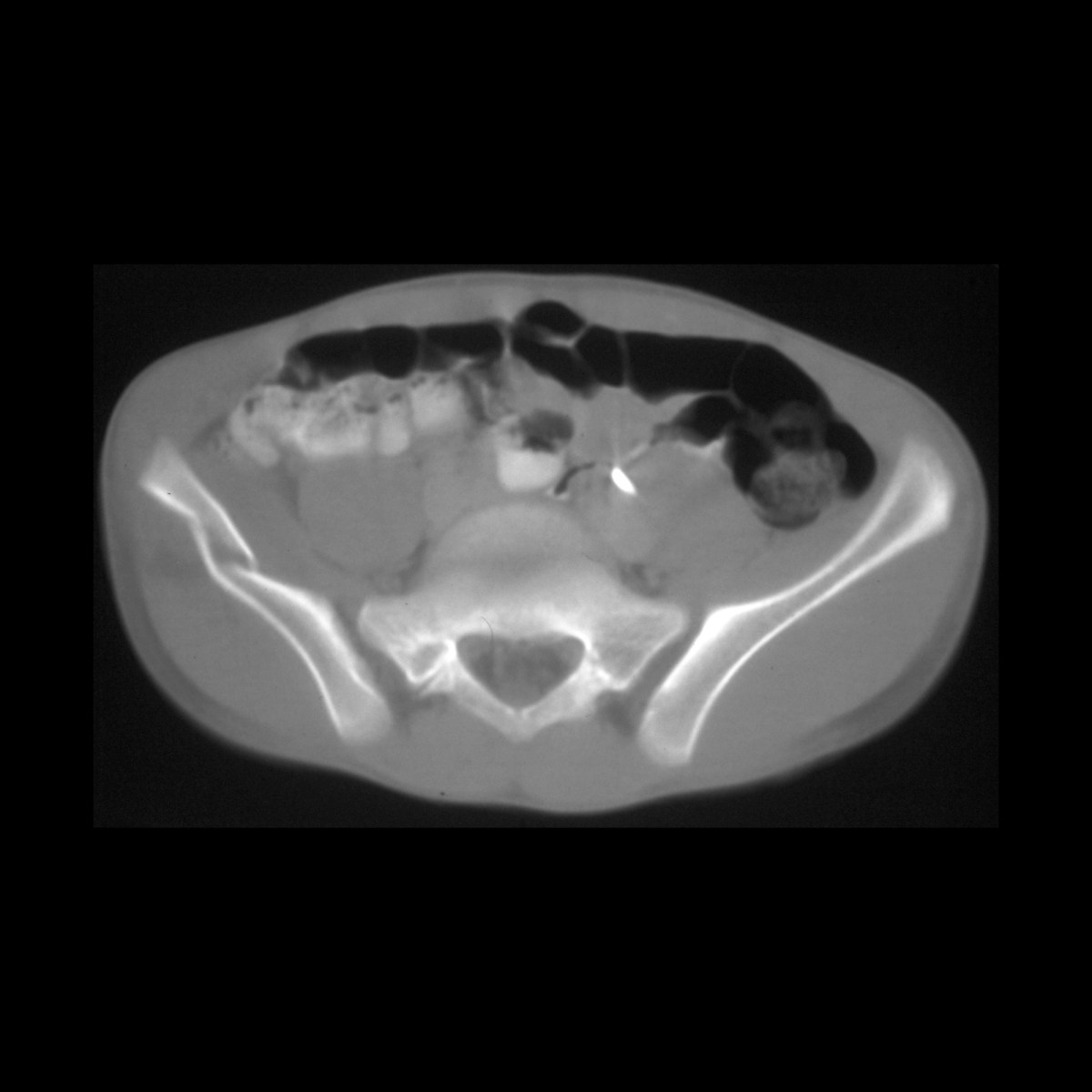 School ager on a bike hit by a car | Pediatric Radiology Case ...