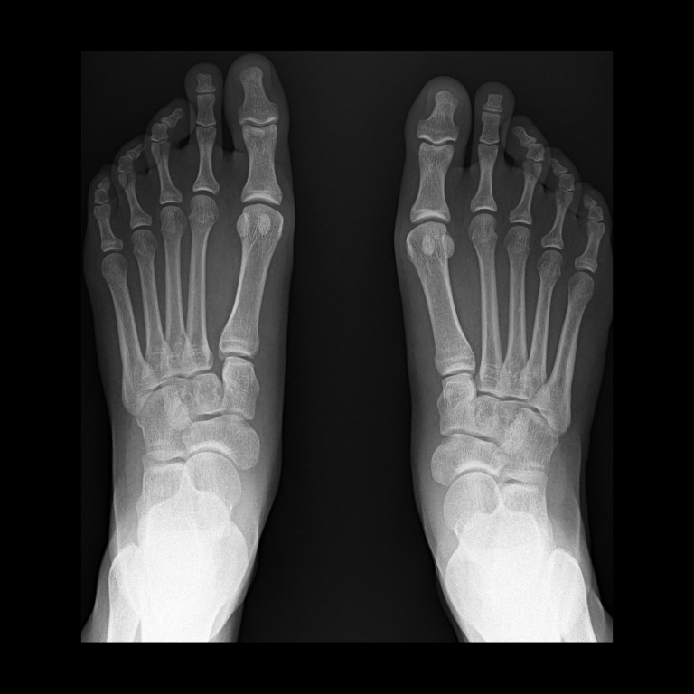 Pediatric Radiology : Pediatric Imaging : A Pediatric Radiology ...