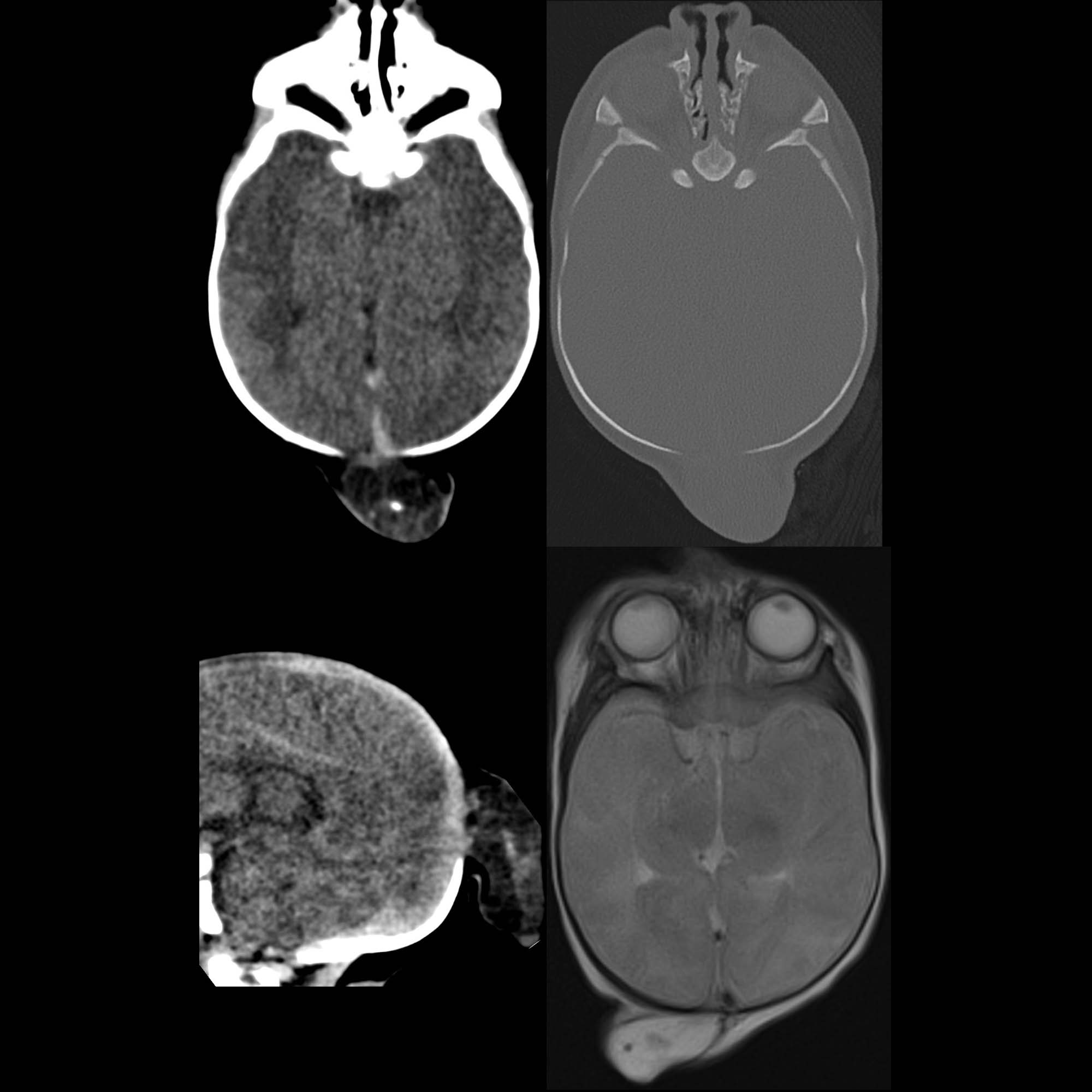 Neurological – Pediatric Imaging