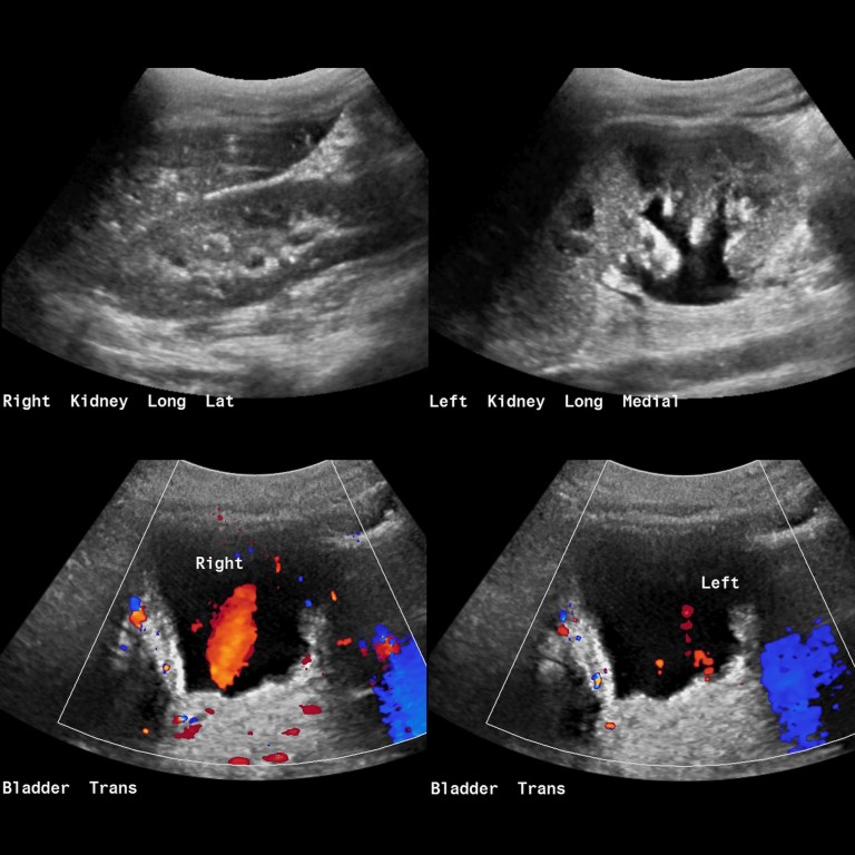 Genitourinary – Pediatric Imaging