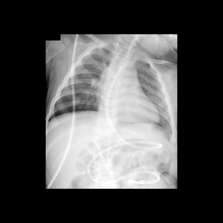 Pediatric Radiology : Pediatric Imaging : A Pediatric Radiology ...