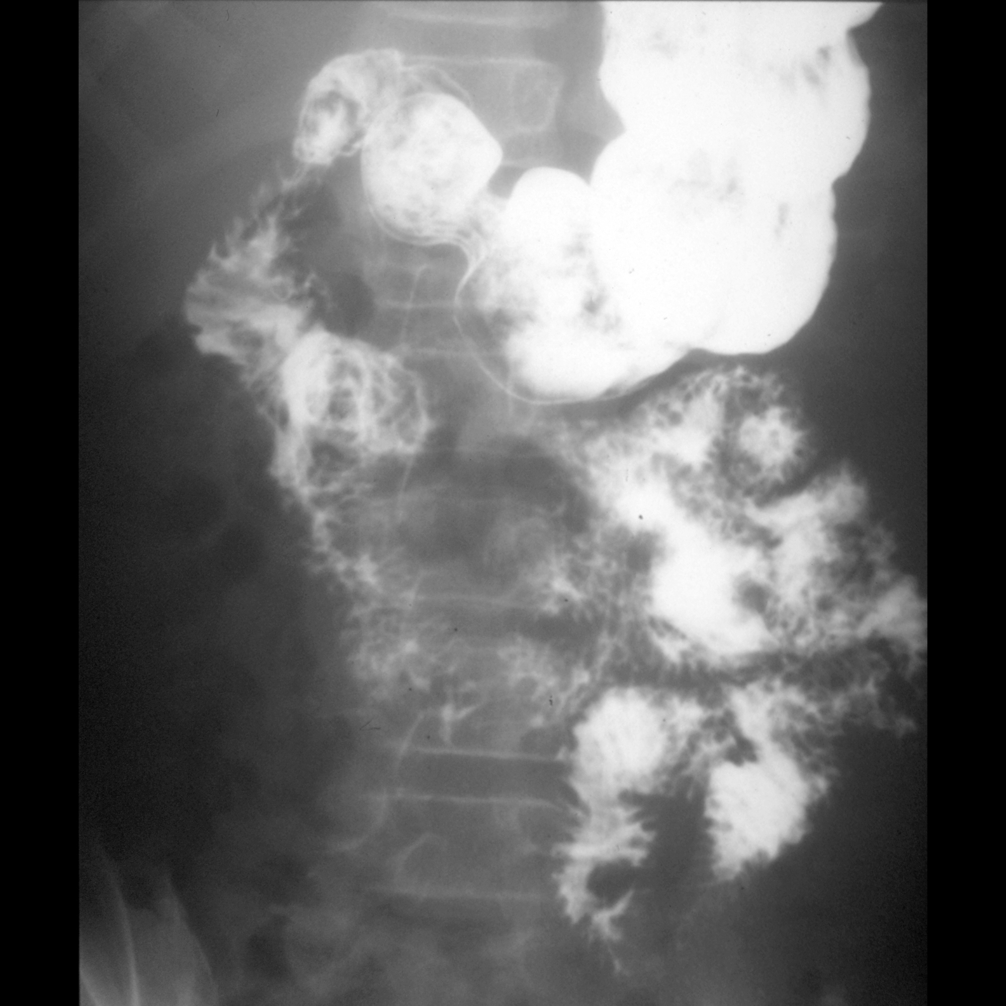 Gastrointestinal – Pediatric Imaging
