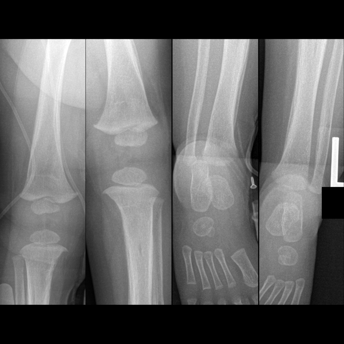 Musculoskeletal – Pediatric Imaging