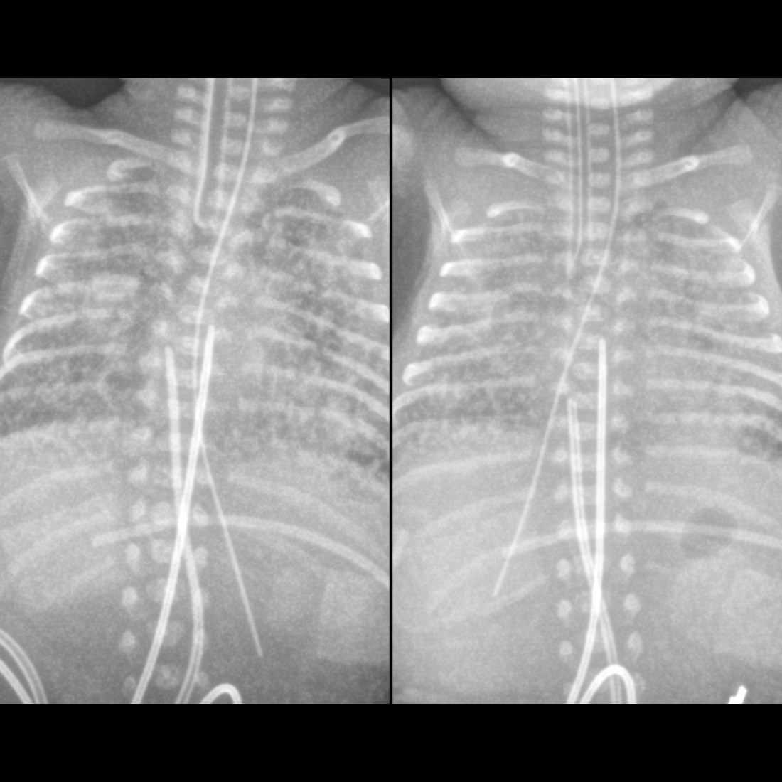 Gastrointestinal – Pediatric Imaging
